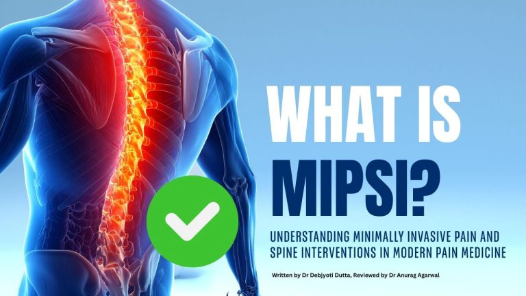 What is MIPSI? Understanding Minimally Invasive Pain and Spine ...